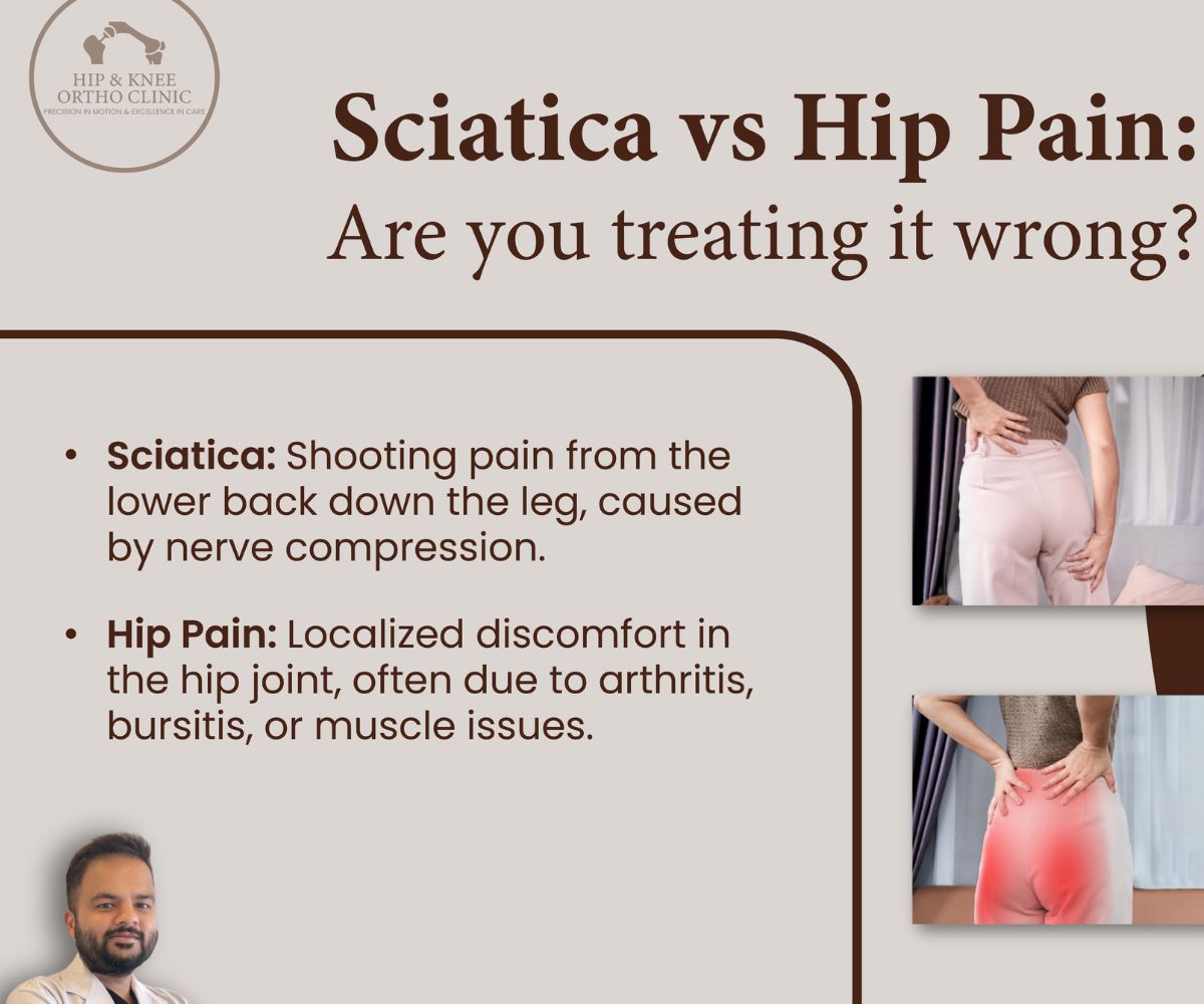 Sciatica or Hip Pain? Know the Difference!